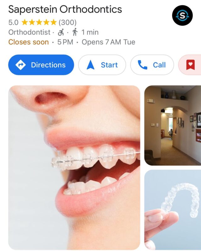 Invisible Braces Nasa